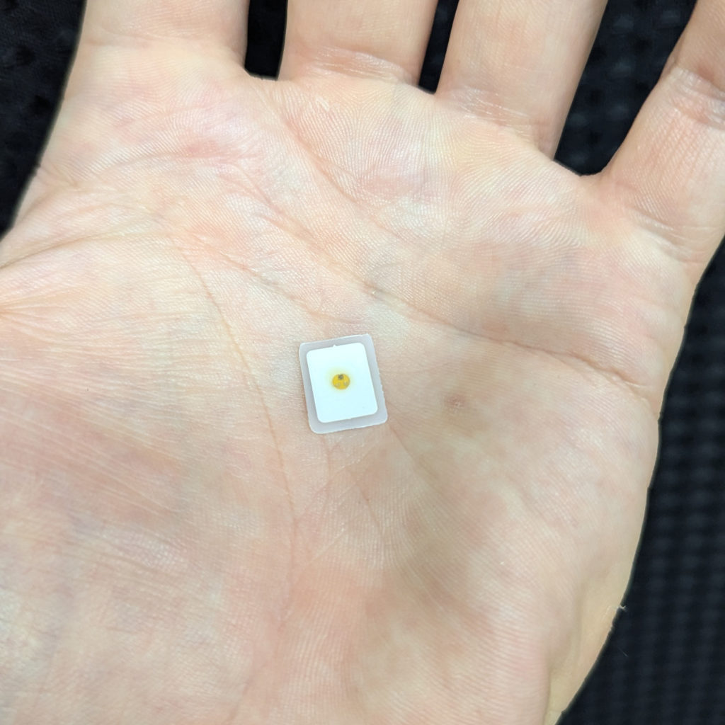 Rfid Chip In Humans Pros And Cons