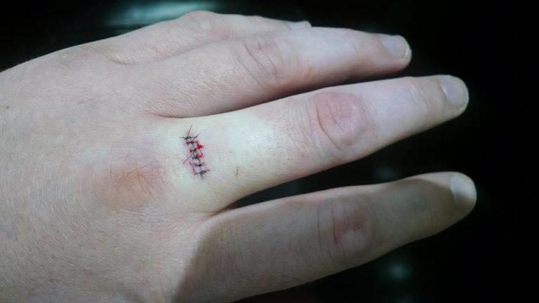 flexNT NFC Chip - RFID & NFC Chip Implants and Biohacking products