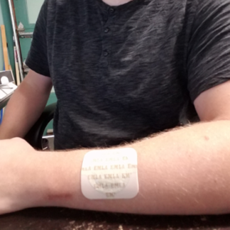 Emla Patch [Topical Anesthetic] - RFID & NFC Chip Implants and ...