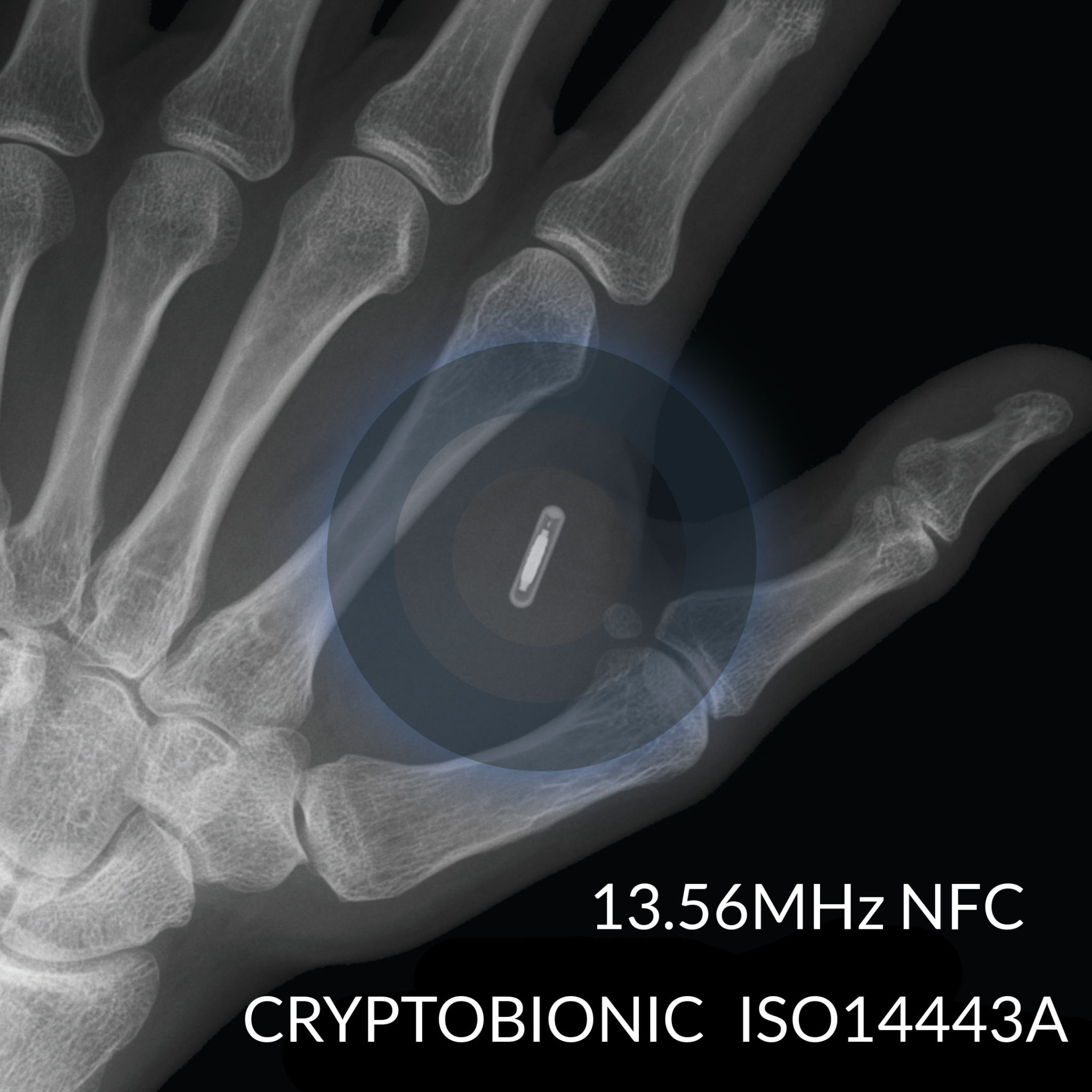 VivoKey Spark 2 [Cryptobionic Implant] - RFID & NFC Chip Implants and ...