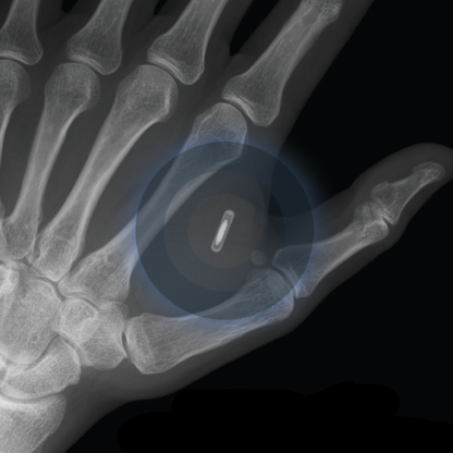 RFID & NFC Chip Implants and Biohacking products | Dangerous Things