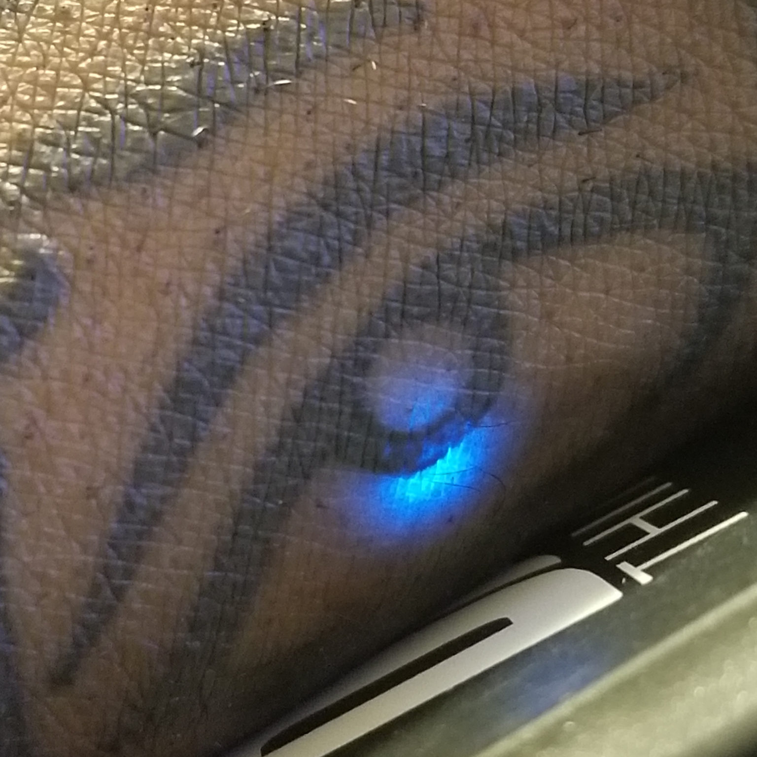 xSIID NFC + LED Implant - RFID & NFC Chip Implants and Biohacking products