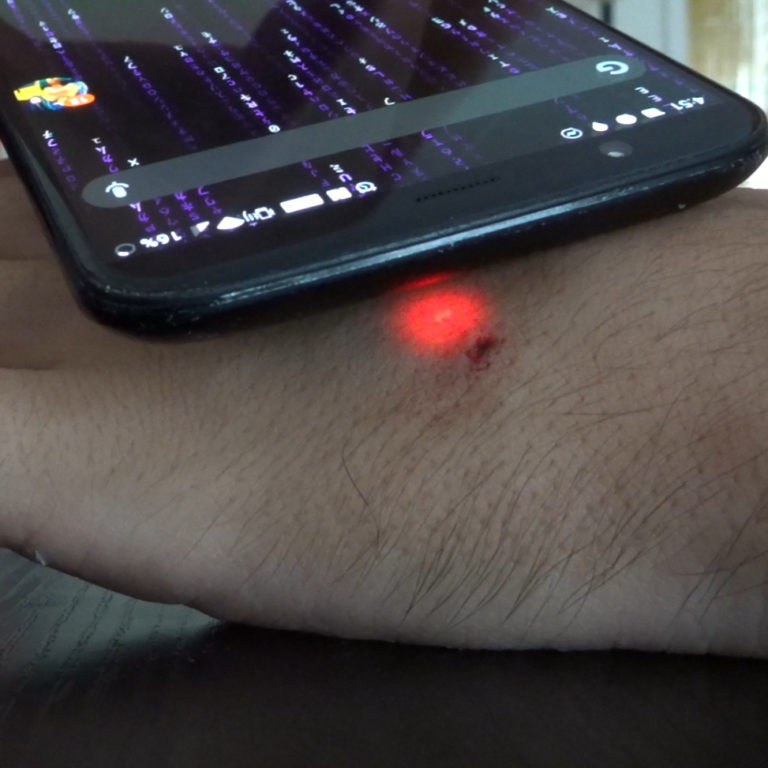 xSIID NFC + LED Implant - RFID & NFC Chip Implants and Biohacking products